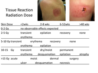 RADIATION SAFETY IN CATHLAB | PPTX
