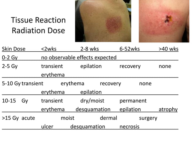 RADIATION SAFETY IN CATHLAB | PPTX | Skin and Dermatology | Diseases ...