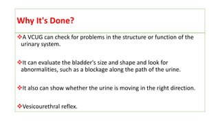 Voiding Cystourethrogram (VCUG) | PPTX