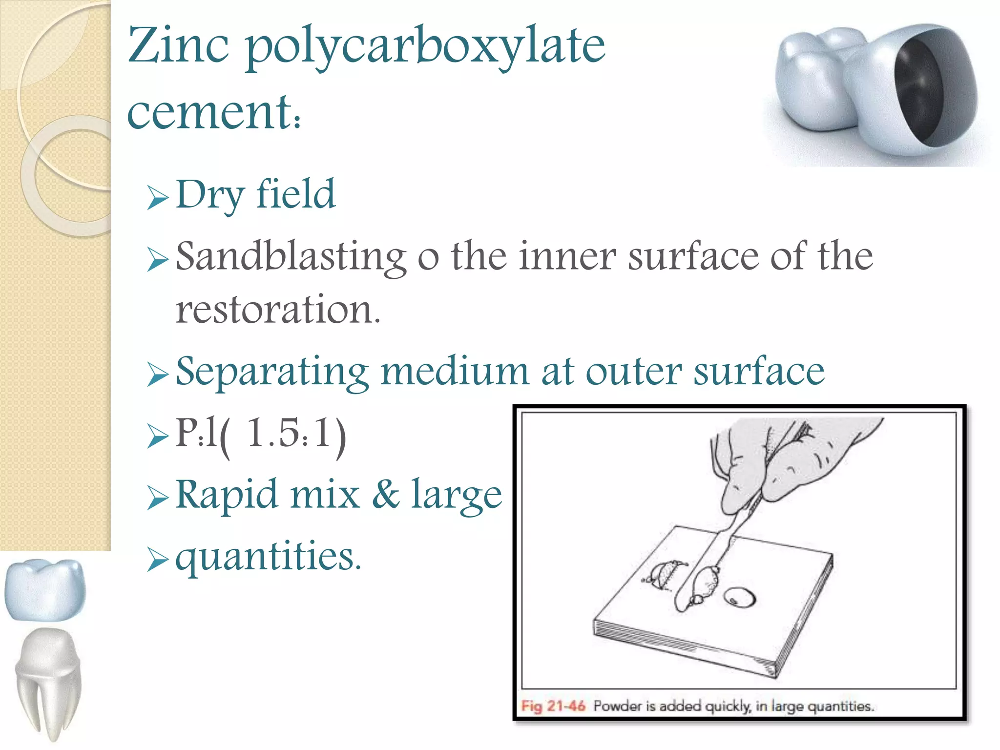 luting cement | PPTX