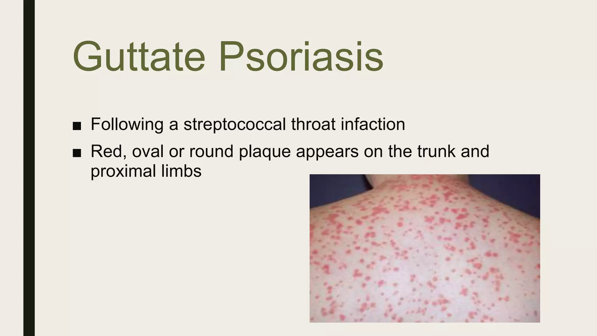 Pityriasis and psoriasis | PPTX