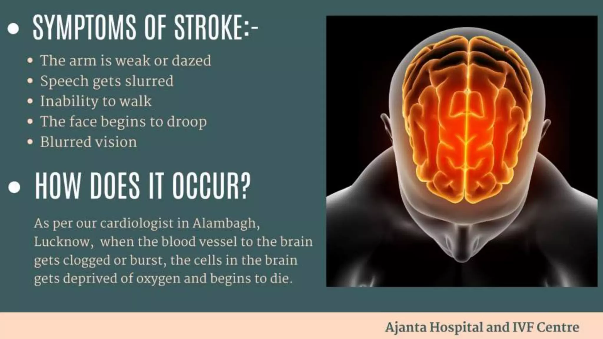 Understanding Heart Attack, Cardiac Arrest and Stroke | PPTX
