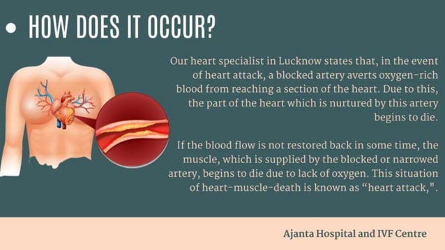 Understanding Heart Attack, Cardiac Arrest and Stroke | PPTX