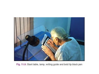 low vision aids | PPT