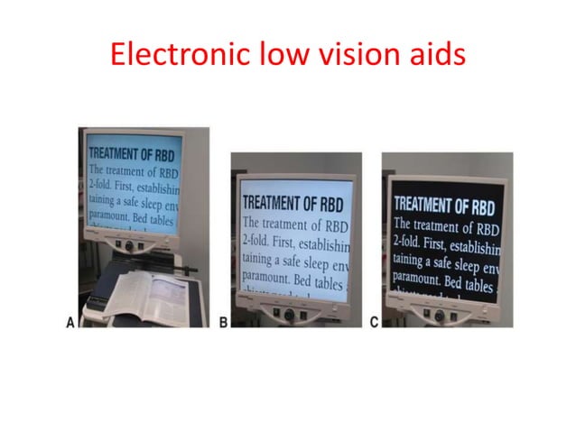 low vision aids | PPTX