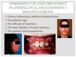classII division 1 malocclusion | PPTX