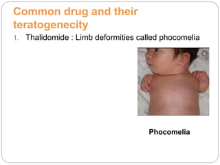 Teratogenecity & Safety of drugs in pregnancy | PPTX