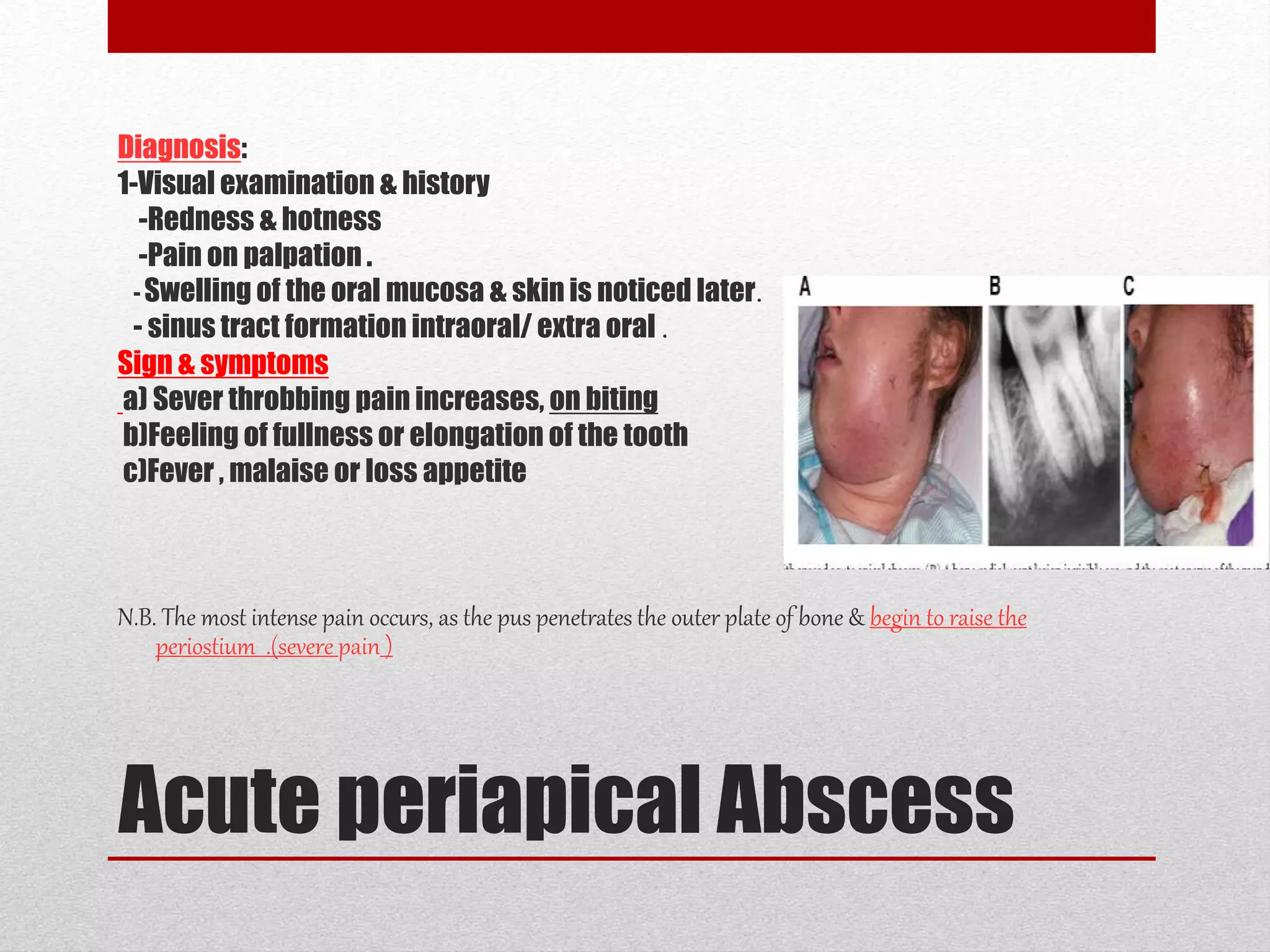 pup and periapical diagnoses | PPTX