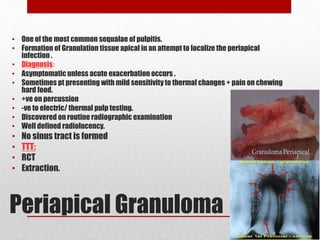 pup and periapical diagnoses | PPTX