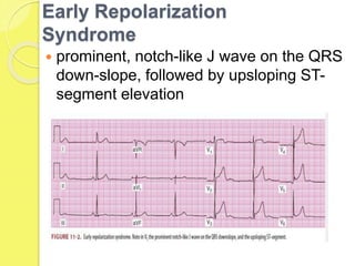 sudden cardiac death | PPTX