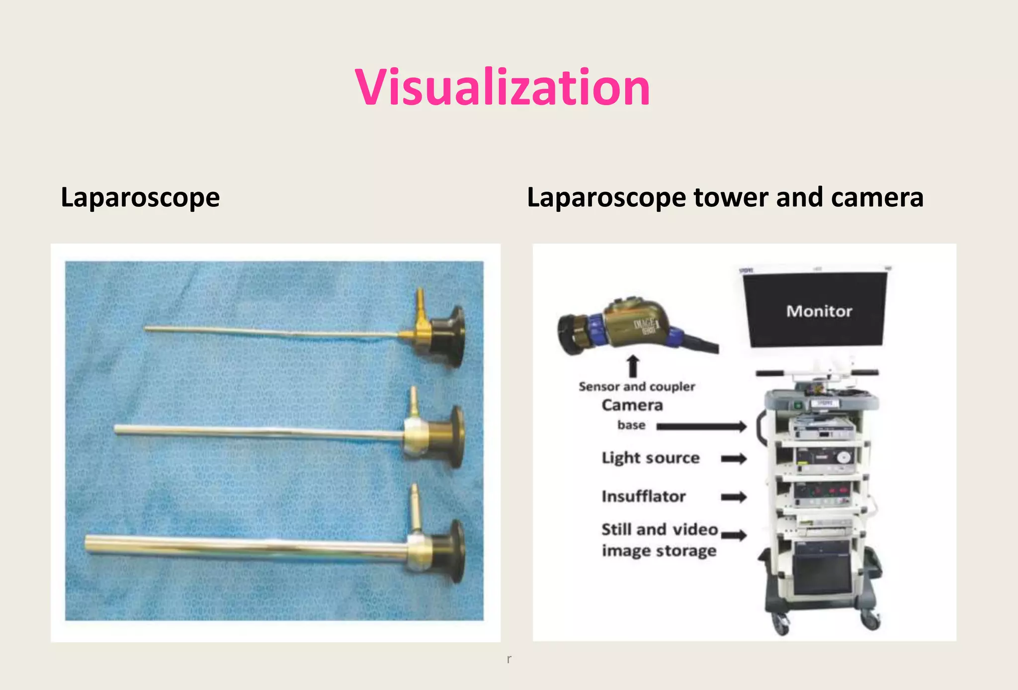 Endoscopy and laparoscopy in gynecology and obstetric | PPTX