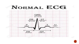 ECG- Leads and technical aspects of ecg | PPT