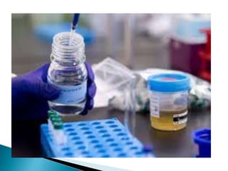 forensic urine drug testing | PPTX
