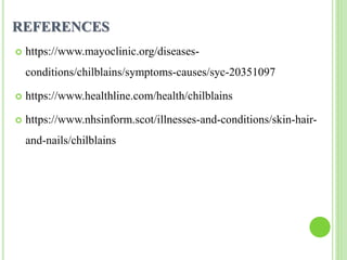 CHILBLAINS | PPTX