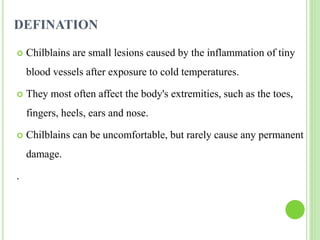 CHILBLAINS | PPTX