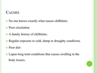 CHILBLAINS | PPTX
