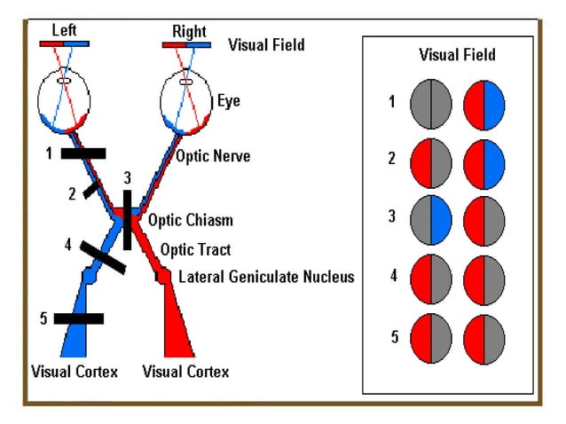 OPTIC NERVE & VISUAL PATHWAY | PPTX | Eye and Vision Conditions ...