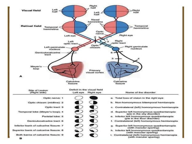 OPTIC NERVE & VISUAL PATHWAY | PPTX | Eye and Vision Conditions ...
