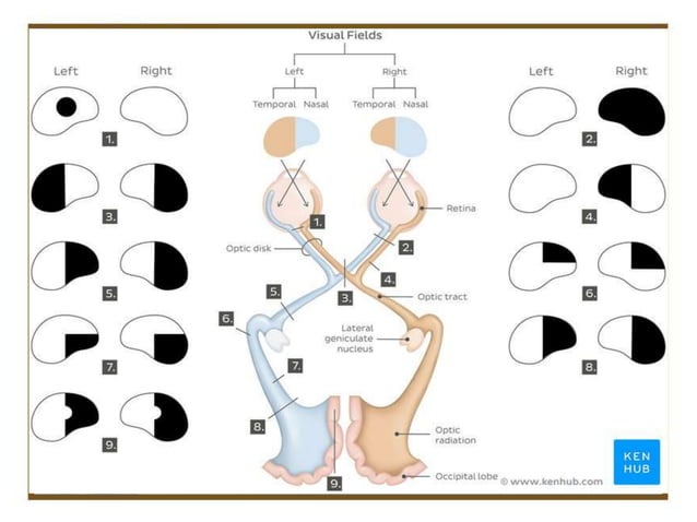 OPTIC NERVE & VISUAL PATHWAY | PPTX | Eye and Vision Conditions ...