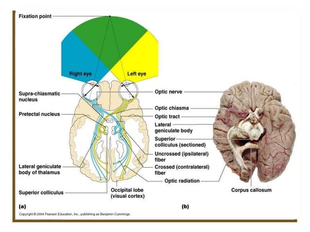 OPTIC NERVE & VISUAL PATHWAY | PPTX | Eye and Vision Conditions ...