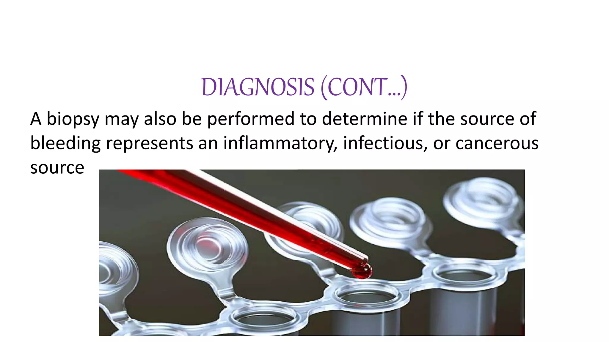 Hematemesis- vomiting of blood , a brief study | PPTX