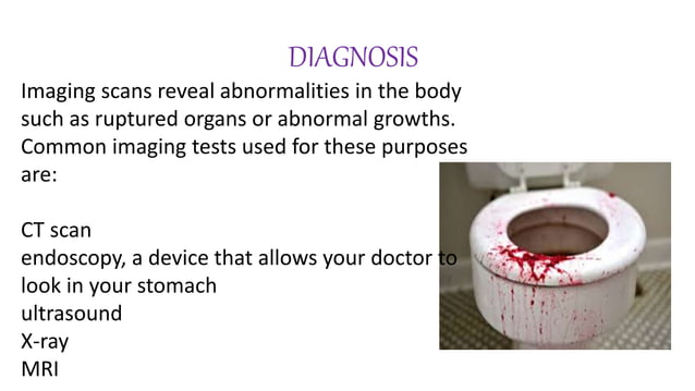 Hematemesis- vomiting of blood , a brief study | PPTX | Digestive ...