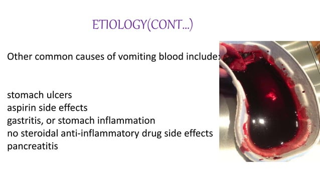 Hematemesis- vomiting of blood , a brief study | PPTX | Digestive ...