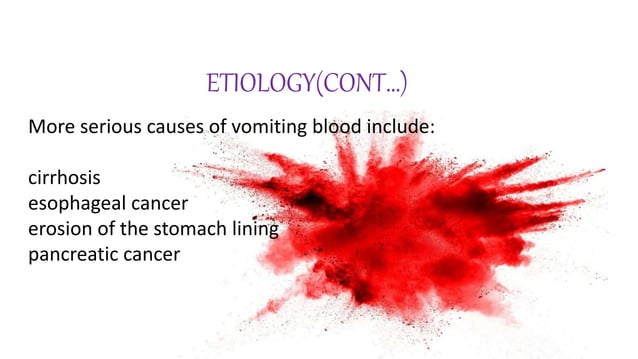 Hematemesis- vomiting of blood , a brief study | PPTX | Digestive ...