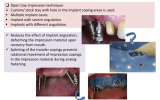 Implant impressions- journal club - Accuracy of implant impressions using various impression ...