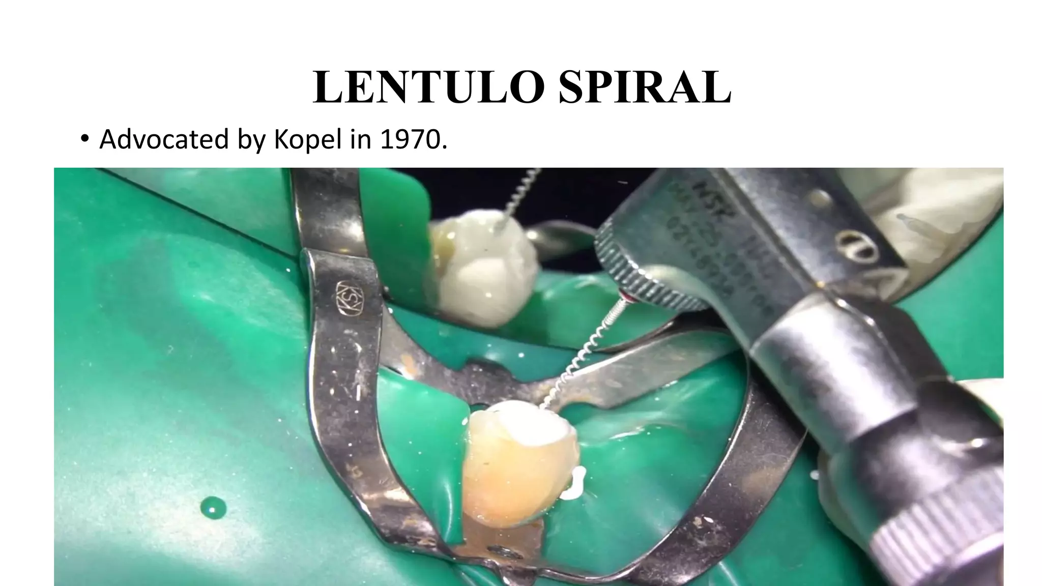 Obturation Techniques in Primary Teeth | PPTX