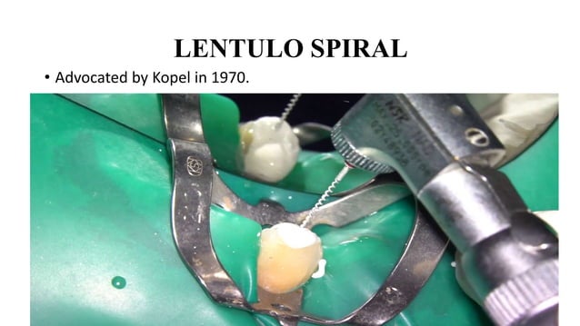 Obturation Techniques in Primary Teeth | PPTX | Dental Health ...