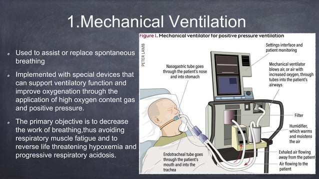 Mechanical Ventilation modes used clinically | PPTX | Lung and ...