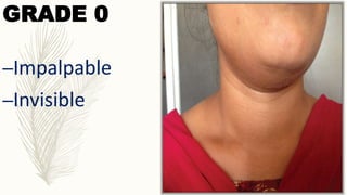 Goiter | PPT