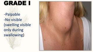 Goiter | PPT