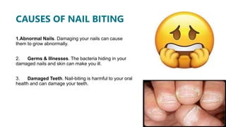 NAIL BITING | PPT | Free Download