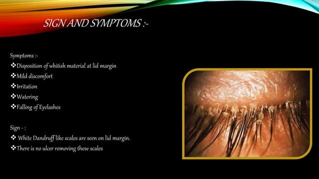 Diseases of eyelid | PPTX