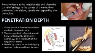 Inferior Alveolar Nerve Block | PPTX