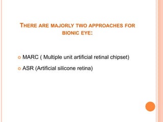 BIONIC EYE | PPTX