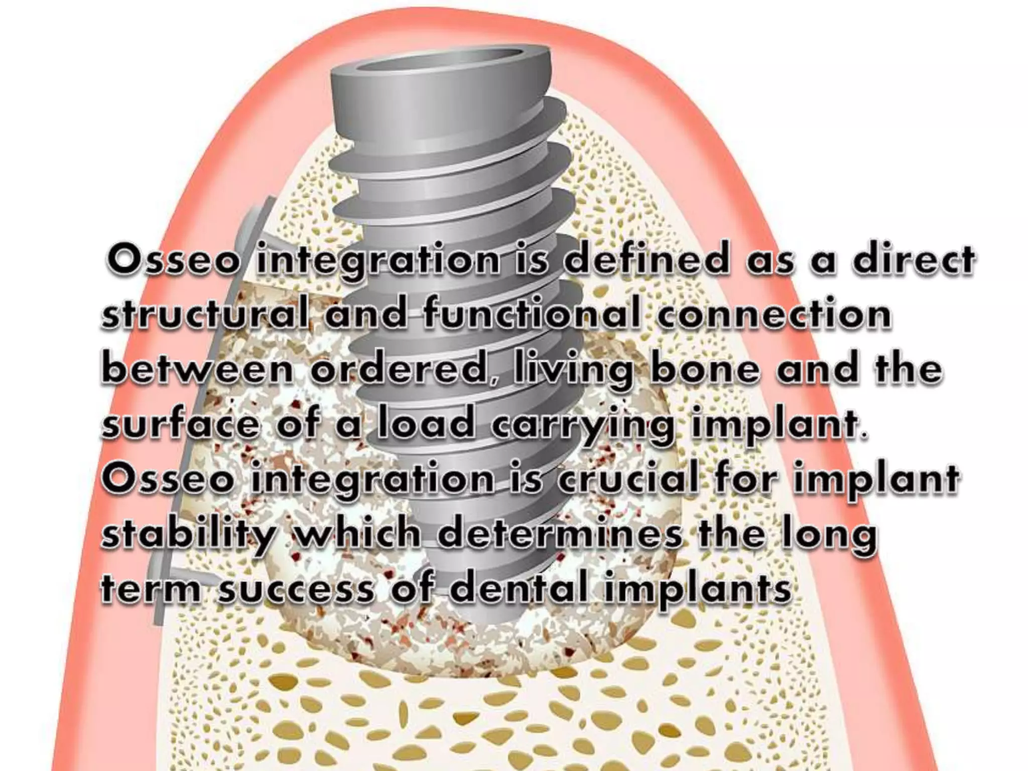 OSSEODENSIFICATION | PPTX