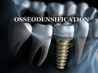 OSSEODENSIFICATION | PPTX