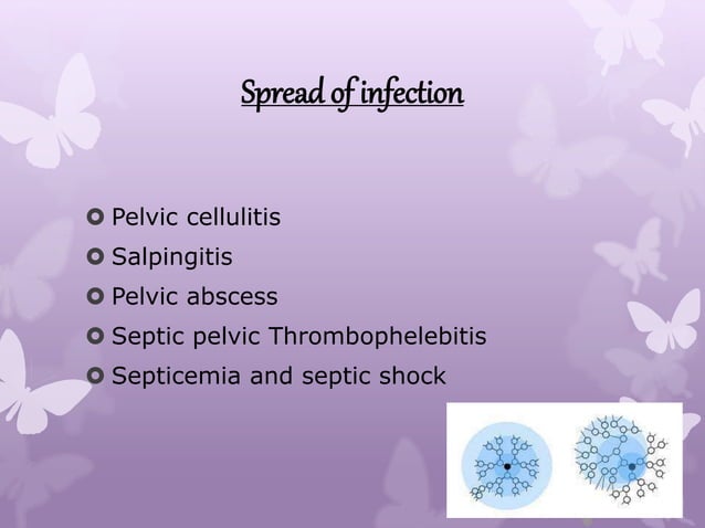 PUERPERAL SEPSIS | PPTX