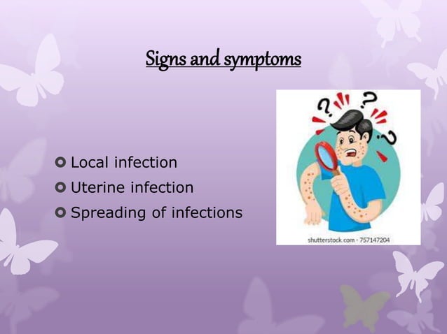 PUERPERAL SEPSIS | PPTX
