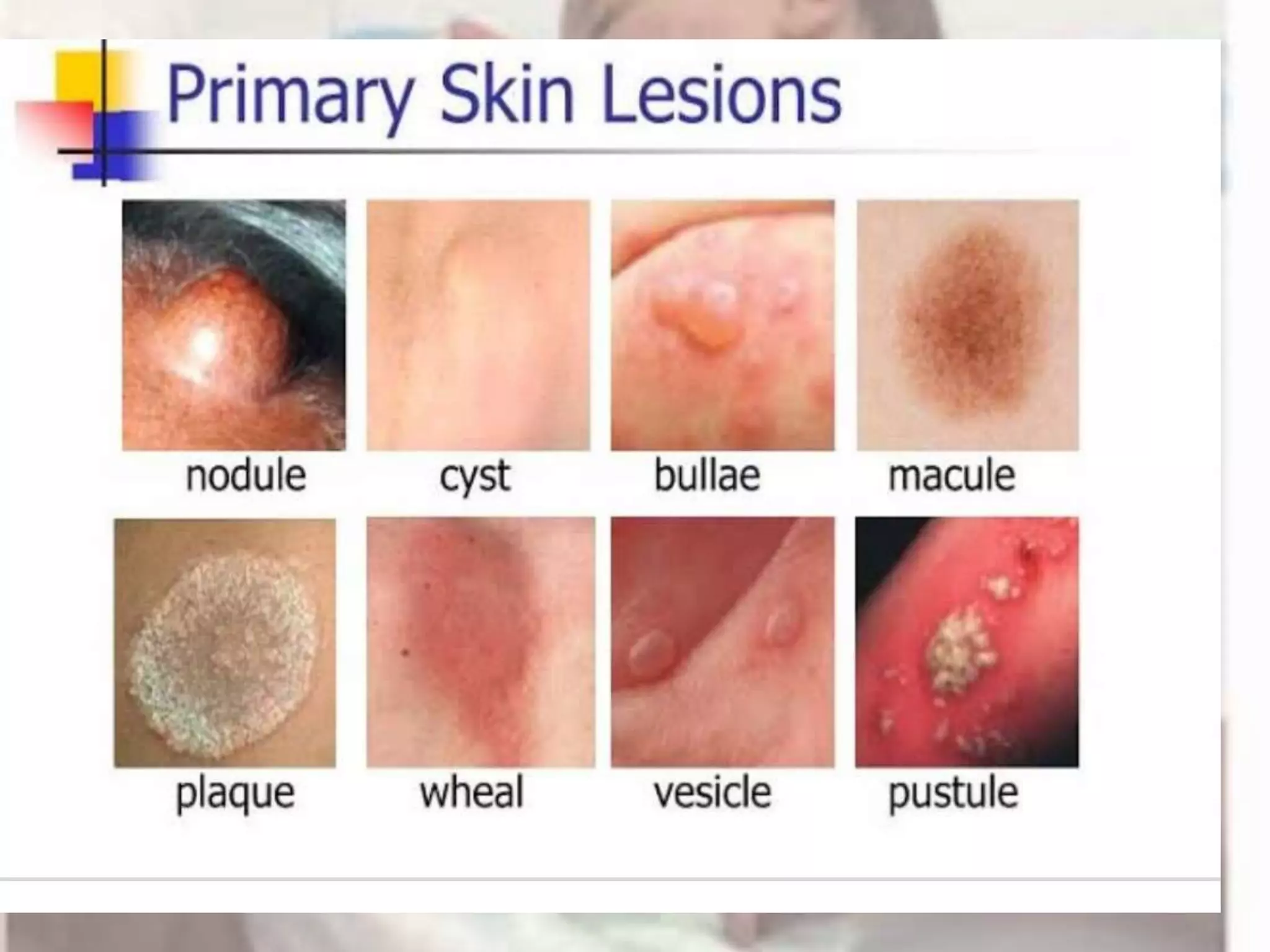 Examination of Skin | PPTX