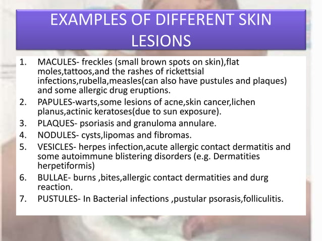Examination of Skin | PPTX