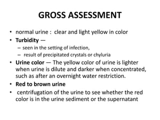 urine analysis | PPTX
