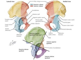 ACETABULAR FRACTURE AND MANAGEMENT | PPTX | Death, Injury, or Military ...