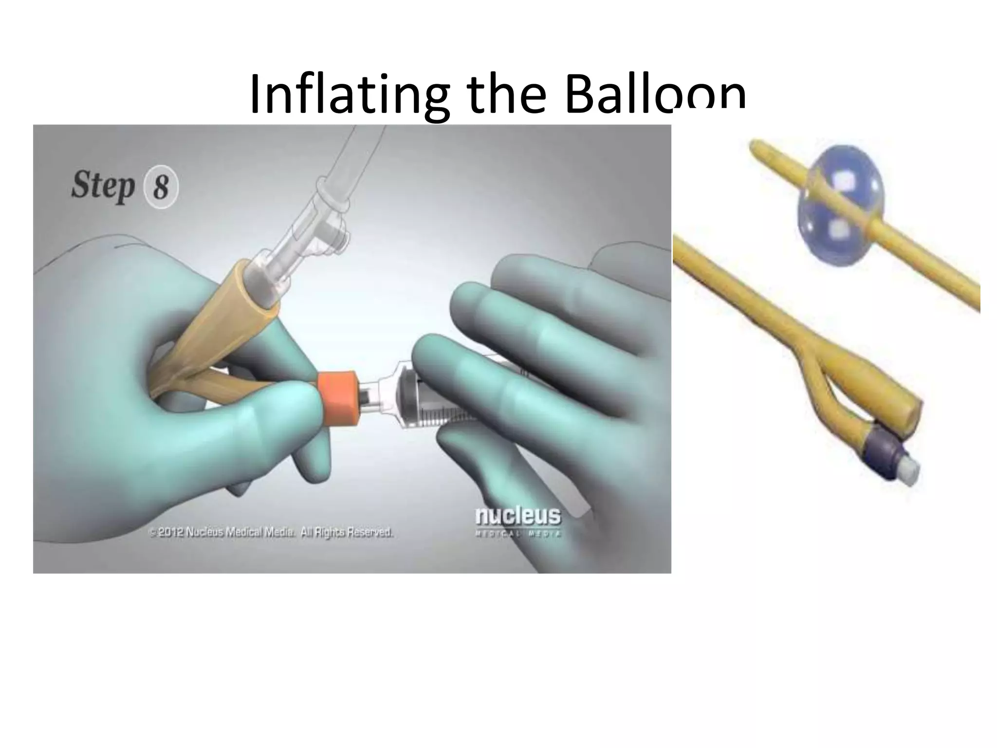 Urinary catheterization Procedure | PPTX
