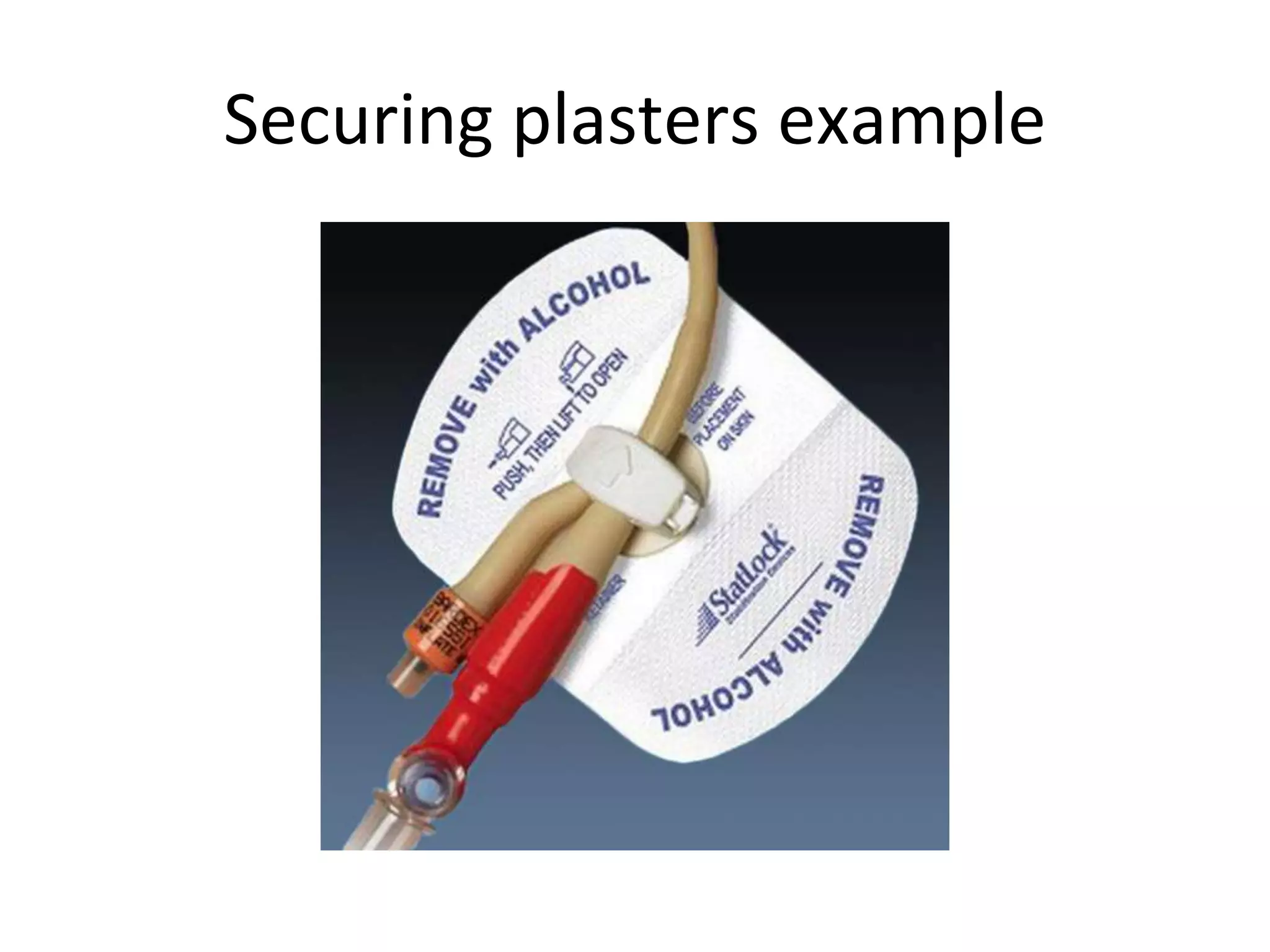 Urinary catheterization Procedure | PPTX