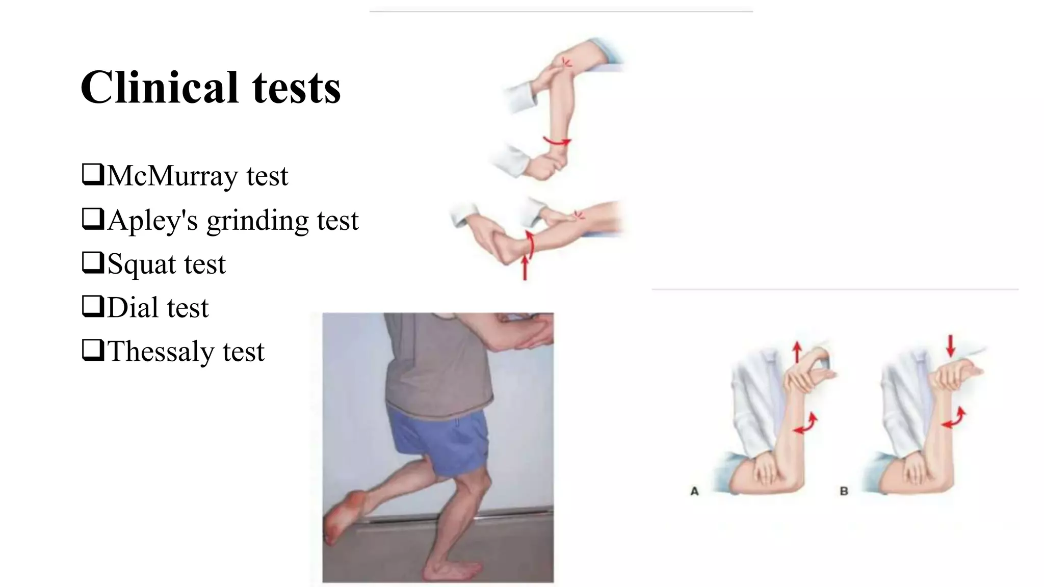 Meniscus injury for postgraduate | PPTX