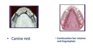 Presentation (1).pptx | Dental Health | Diseases and Conditions